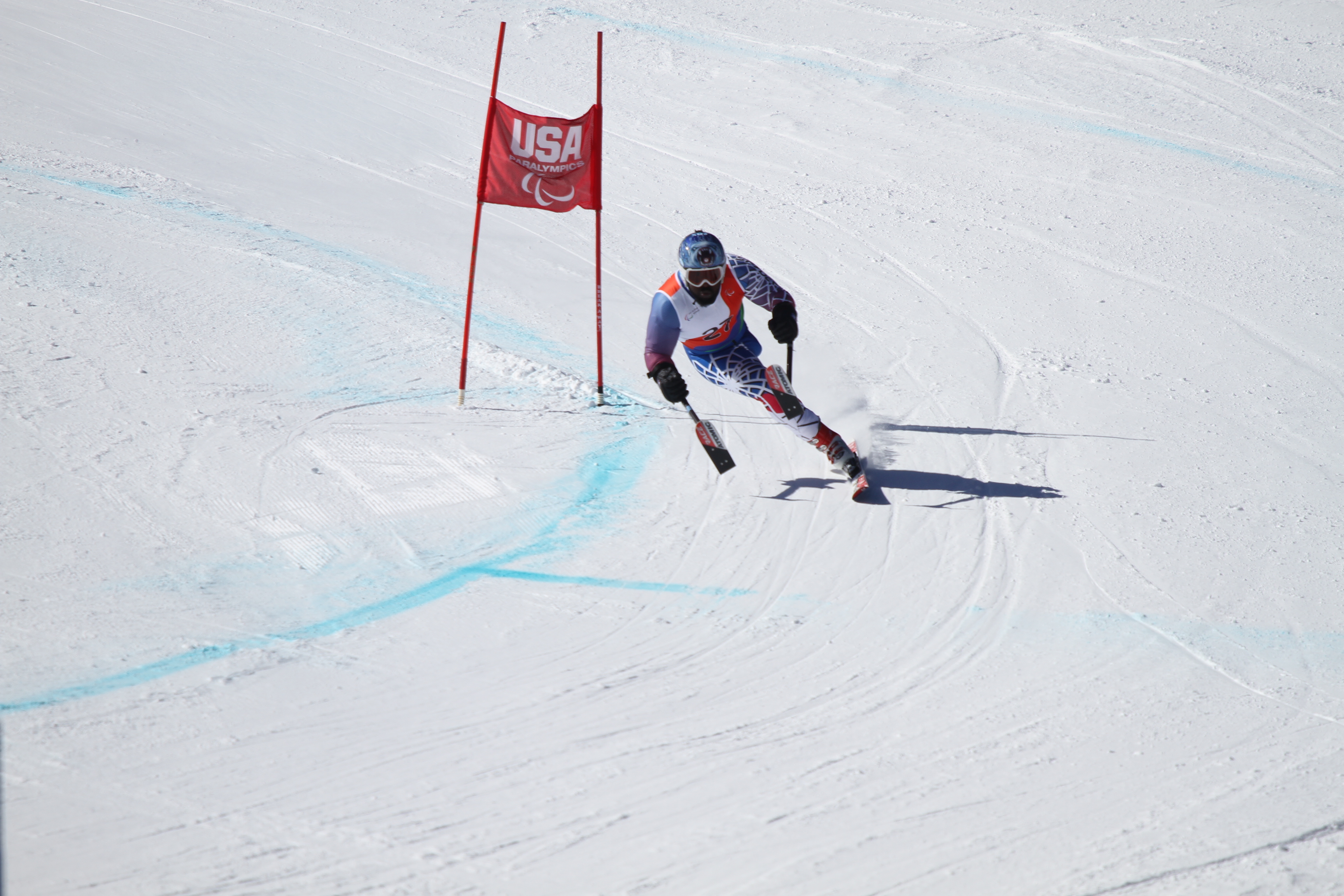 From the Brooklyn streets to hurtling down a mountain at 75mph on one leg